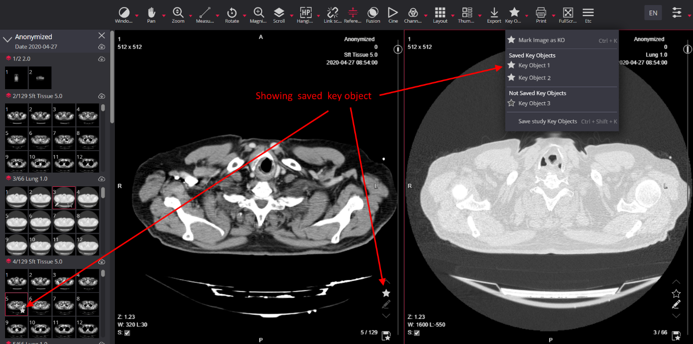 Key Objects – AlemHealth